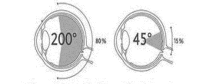 Eidon Retinal Screening - Access Eye